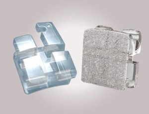 Brackets de Zafiro en Tacna | Totalmente Estéticos