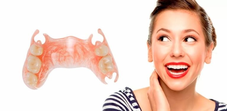 Prótesis flexibles removibles | Clínica Dental Tacna